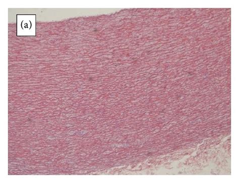 Porcine Vascular Grafts A Acellular Graft After Decellularization In Download Scientific