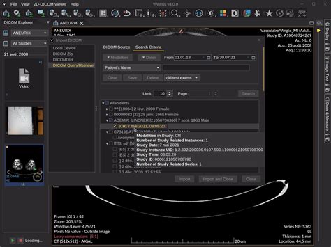 Weasis Free Dicom Viewer Weasis Documentation