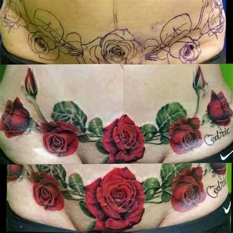 Tummy Tuck Tattoo Cover Ups Jeryjet