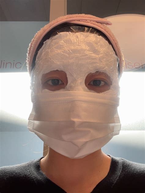 평편사마귀 제거어븀야그레이저사마귀레이저피부시술1 4일차 네이버 블로그