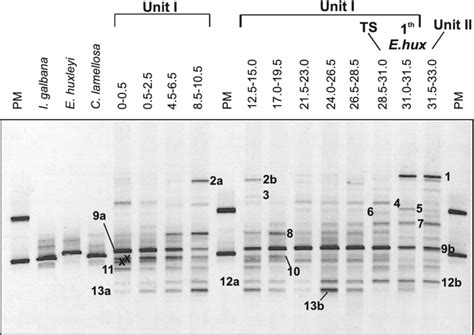 Denaturing Gradient Gel Electrophoresis Dgge Analysis Of The