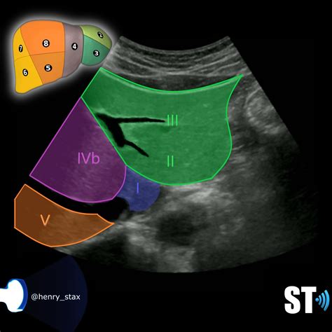 Couinauds Liver Segments Sonographic Tendencies