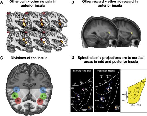 Divisions Of The Insula Cortex And Relevance For The Processing Of Download Scientific Diagram