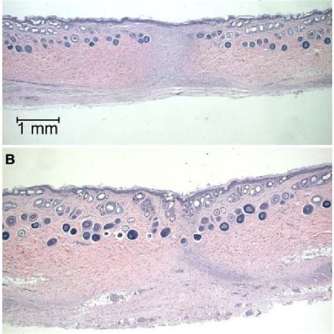 Histological Sections HE Staining 6 Weeks After Surgery A And B Download Scientific