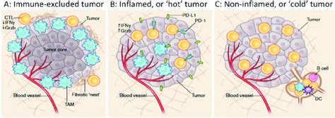 The Tumour Immune Microenvironment Can Be Classified As Being Either Download Scientific