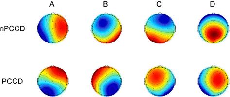 Figure 1 From Eeg Microstates In Epilepsy With And Without Cognitive