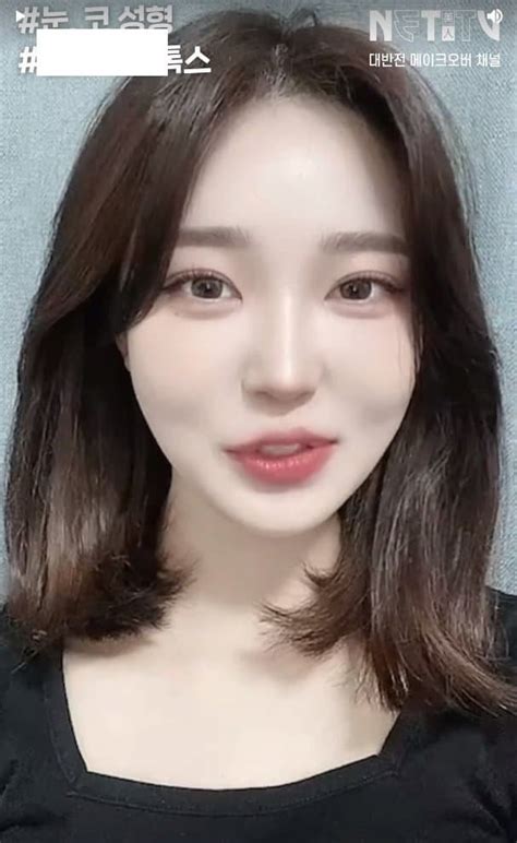흔녀 성형 수술 전후사진 포텐 터짐 최신순 에펨코리아