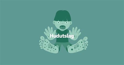 Utslag På Hud Hos Barn På Förskola Här är Råd För Föräldrar Om Sjukdom Och Vab Svt Nyheter