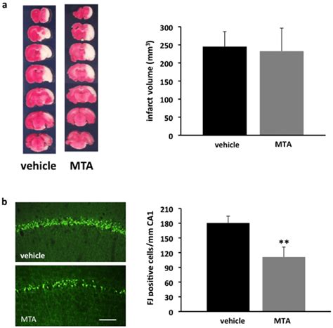 Effect Of Mta On Brain Ischemia A Representative Ttc Stained