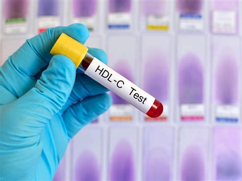 HDL CHOLESTEROL TEST