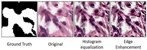 Example For Applying Prepossessing Step On Original Patch Histogram
