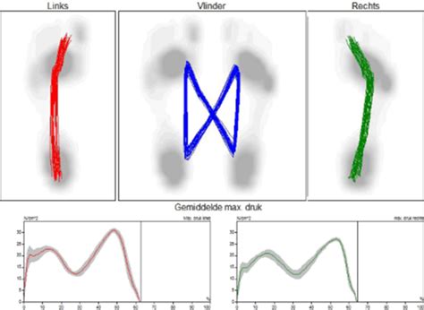 Gang En Loopanalyse Az Oostende Gang En Loopanalyse Az Oostende