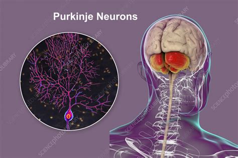 Cerebellum And Purkinje Neurons Illustration Stock Image F0456286
