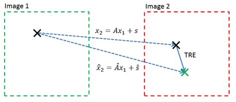 A Diagram Illustrating The Target Registration Error As The Difference