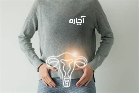آیا تخمدان پلی کیستیک خطرناک است؟ 6 بیماری جدی آچاره سلامت