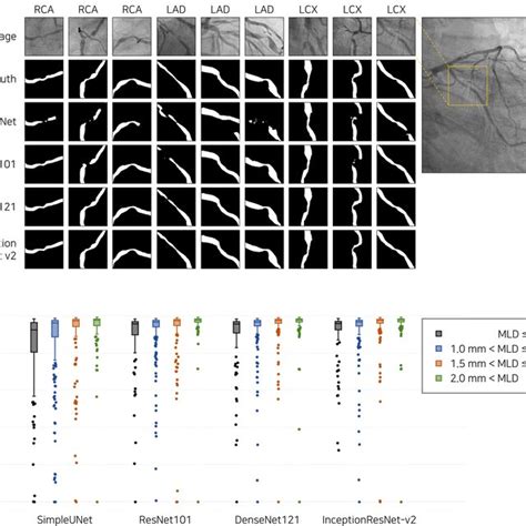 Representative Examples Of Major Vessel Segmentation In The Bounding Download Scientific
