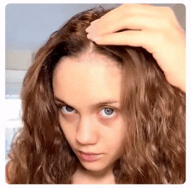 Scalp Folliculitis Therapy Oil ConfidenceShop