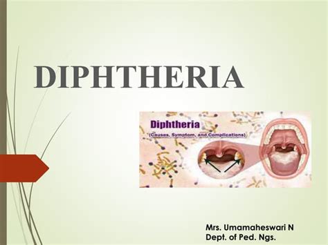 Diphteriapdfdiphtheria Pdf Diphtheria Pdf