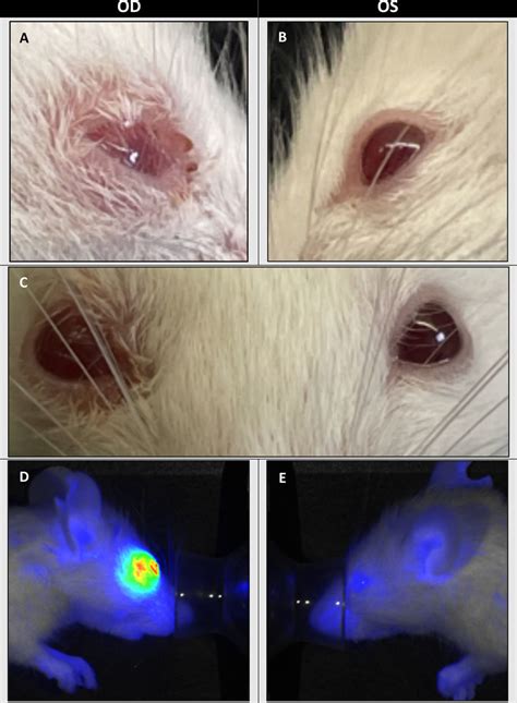 A Image Of Right Eye With Tumor Growth Nsg Mice Were Injected With 5