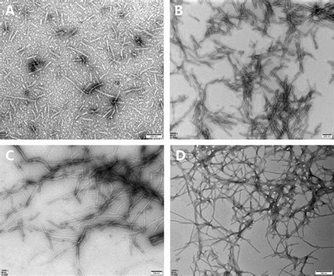 Understanding Tau Pffs And Alpha Synuclein Pffs