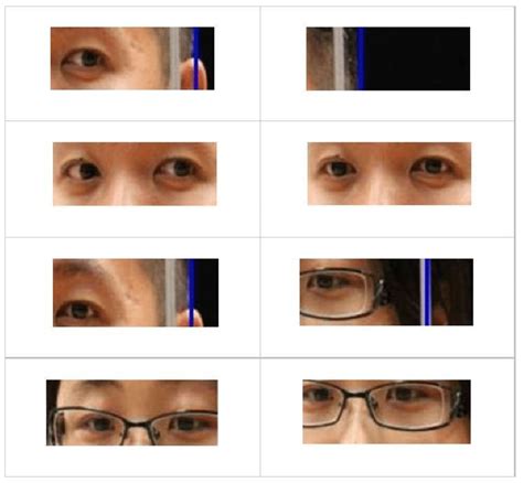 The Extracted Eye Region From Dataset 25 Images Using The Final