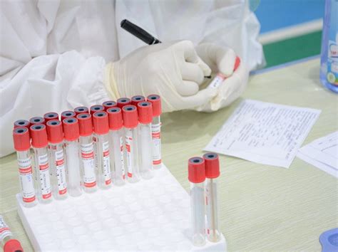 Улсын хэмжээнд коронавируст халдварын 56 тохиолдол бүртгэгджээ ТАС МН