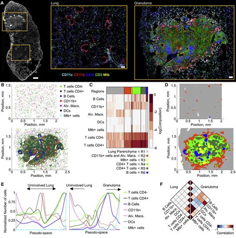 Cytomap Analysis Of Mtb Infected Lung Granuloma A Confocal Image Of A