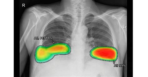 Samsung Taps Lunit For Ai Powered Advanced Chest Screening Dh Arab