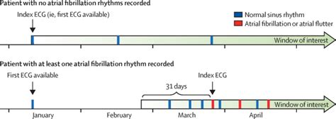 An Artificial Intelligence Enabled Ecg Algorithm For The Identification