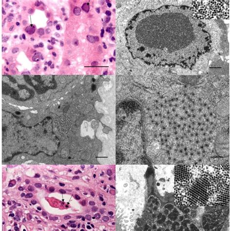 Renal Cortex With Viral Inclusions A Hematoxylin And Eosin Stained Download Scientific