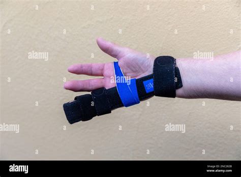How To Put A Splint On A Broken Finger At Louise Collier Blog