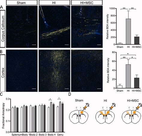 Connectivity Between Ipsilesional And Contralesional Motor Cortices At Download Scientific
