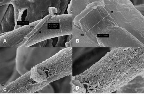 Trichoderma Atroviride La Solución Ecológica Para El Control De Hongos Fitopatógenos