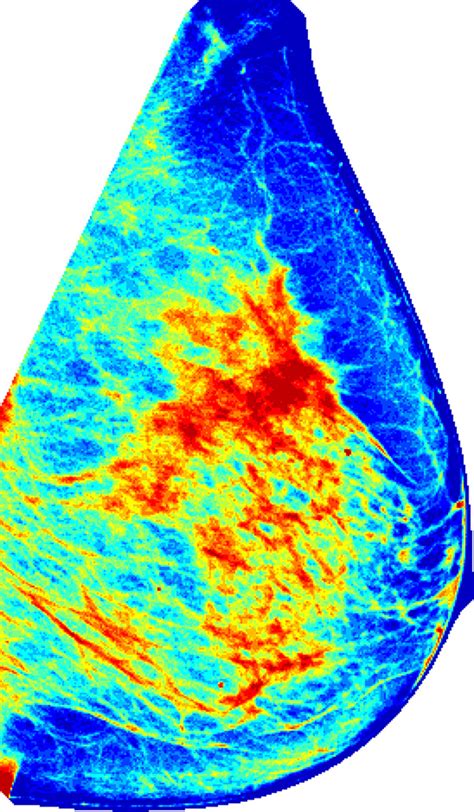 Fully Automated Quantitative Estimation Of Volumetric Breast Density From Digital Breast