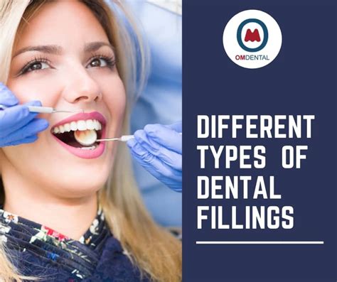 A Guide To Different Types Of Dental Fillings