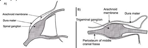 Figure 1 From Subdural Block And The Anaesthetist Semantic Scholar