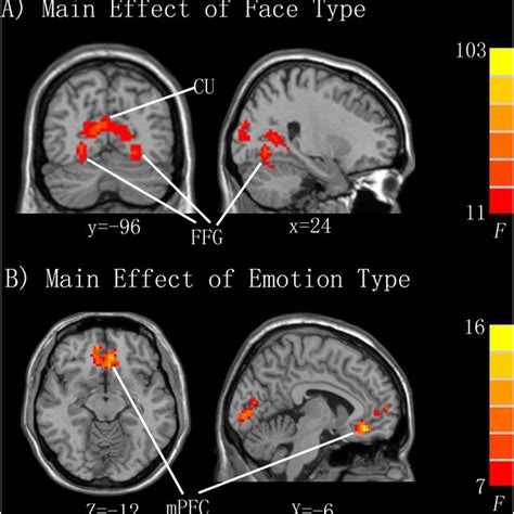 Macaque Cortical Face Processing Network Lateral View Of Macaque Brain Download Scientific