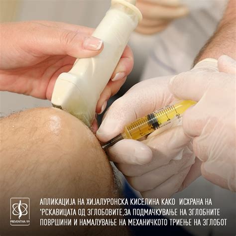 Pzu Preventiva 99 💉 Инјекциите со хијалуронска киселина се користат за третман на болки во