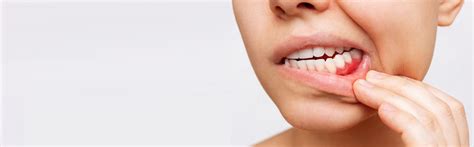 Gingivectomy And Gingivoplasty Procedures Omni Dental Austin Dental Group Omni Dental