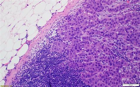 Haematoxylin And Eosin Hande Stain At X200 Magnification Sentinel