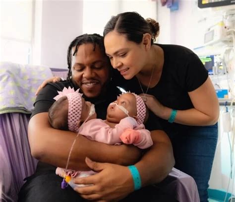 بیمارستانی با موفقیت دوقلوهای به هم چسبیده را پس از یک جراحی ۱۱ ساعته از هم جدا کرد