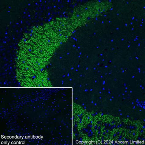 Anti Dynorphin A Antibody Epr28632 17 Ab319045 Abcam