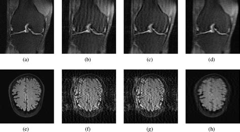 Figure 1 From Physically Primed Deep Neural Networks For Generalized Undersampled Mri