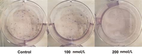 Bufalin Suppresses Ovarian Cancer Cell Proliferation Via Egfr Pathway Pmc