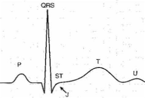 Electrocardiograph Ecgekg Interpretaion