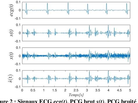 Application De La Factorisation Non Négative Des Matrices Nmf Pour Le