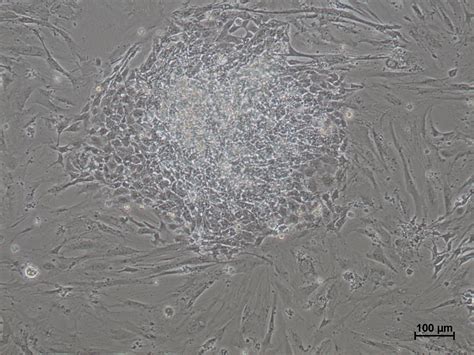 3 Questions With Answers In Somatic Cell Nuclear Transfer Science Topic