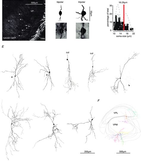Morphology Of Vp Interneurons A Maximum Projection Of Z Stack Images Download Scientific