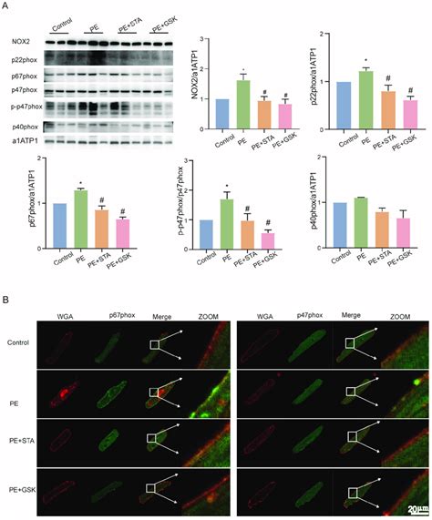 Stachydrine Hydrochloride Sta Decreases Nox2 Expression And Membrane Download Scientific