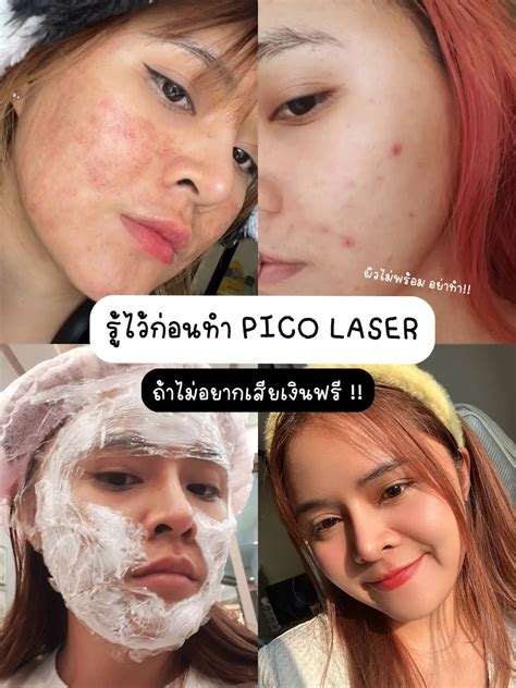Pico Discovery ครั้งเเรก รีวิวชีวิตใน 4 รูป แกลเลอรีที่โพสต์โดย Pahn Ins⊹♡ ༘ Lemon8